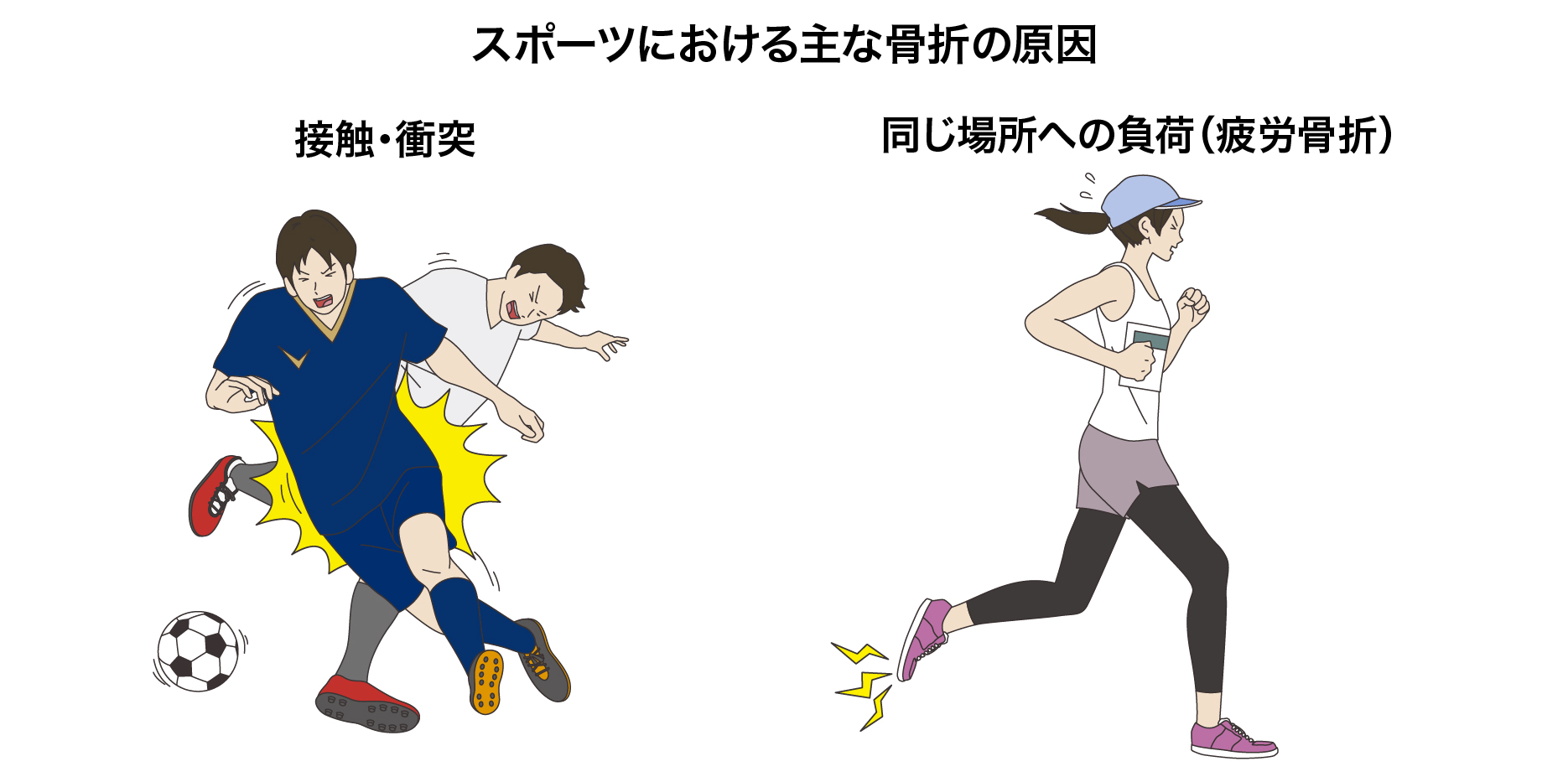 ベストなコンディションにするための食事と栄養（パートⅤ：ケガ・故障の予防）｜アミノ酸スポーツ栄養科学ラボ｜味の素株式会社